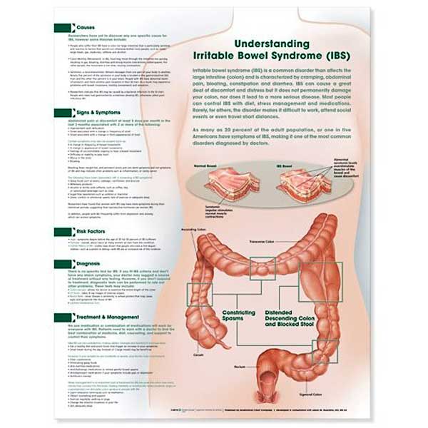 Understanding Irritable Bowel Syndrome Anatomical Chart | Pro Therapy Supplies