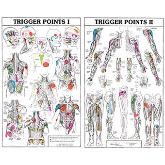 Open Box Trigger Points I and II Chart-Laminated | Pro Therapy Supplies